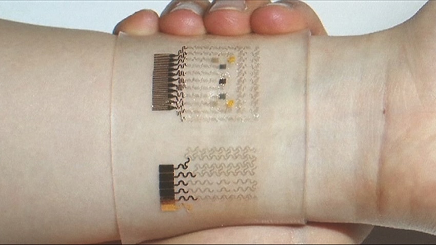 South Korean researchers develop 'diabetes patch' | SBS News South Korean researchers develop 'diabetes patch' | SBS News